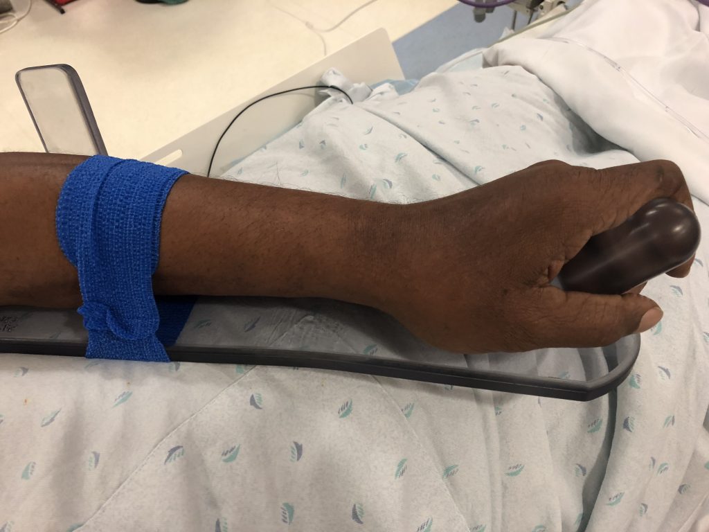 Use - Distal Radial Access Wrist Support - DRAWS